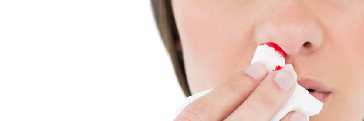 Wat te doen bij een bloedneus van jezelf of iemand anders? - 101BHV.nl